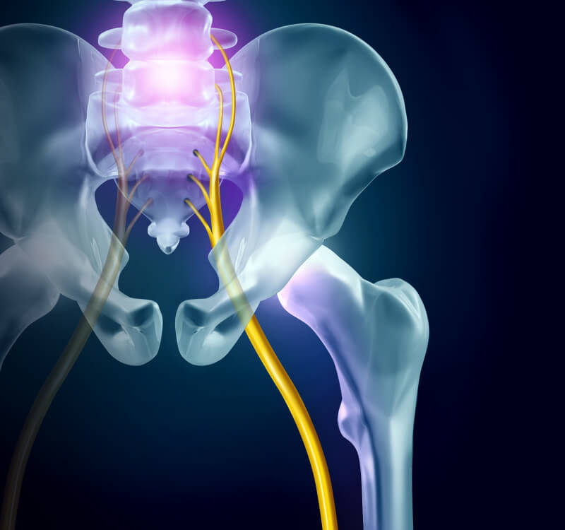 Microtube Spine Surgery | Royal Spine Surgery